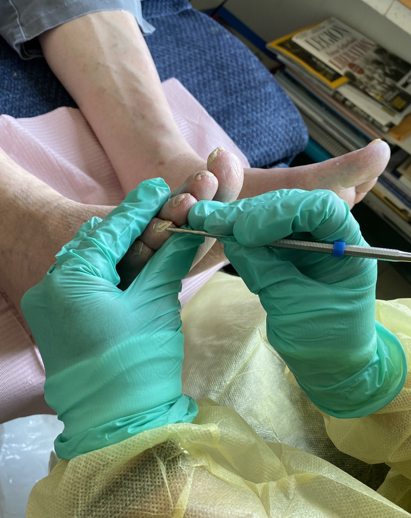 Foot Care Nurse Training in Nova Scotia Overview